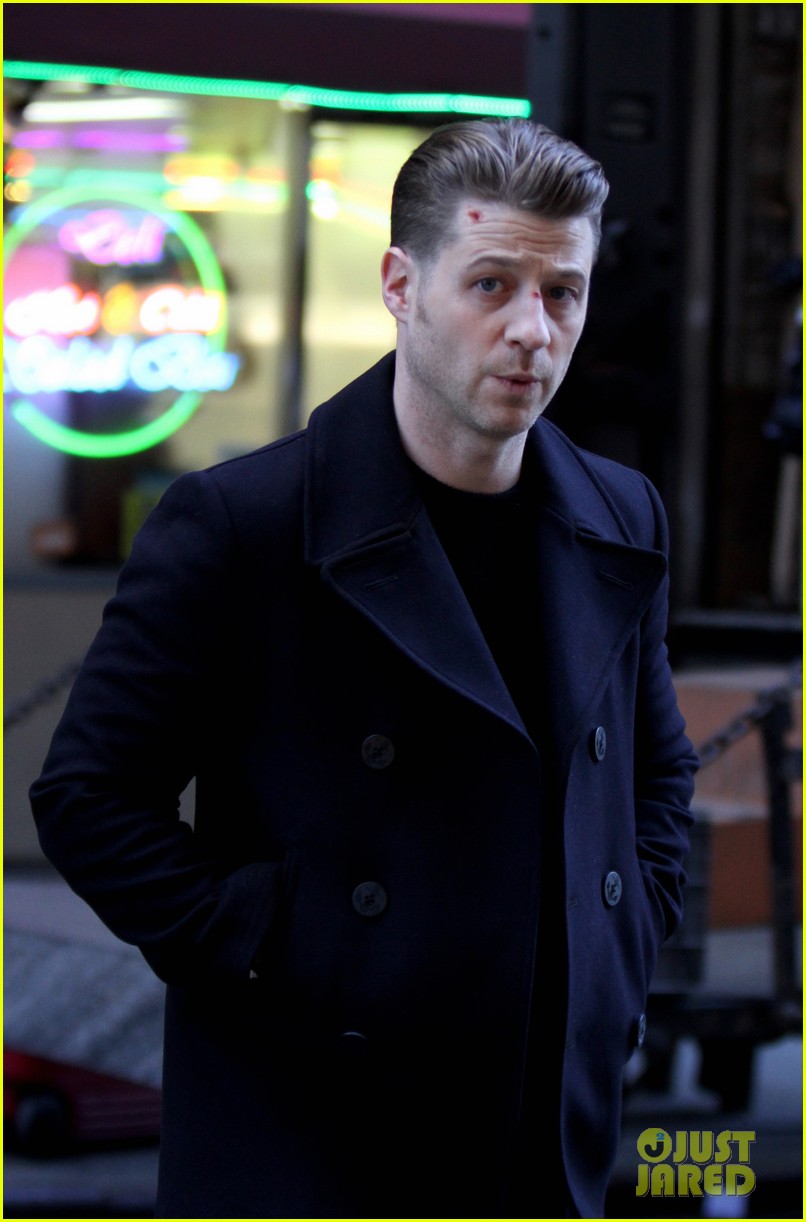 Ben McKenzie Sports Bloody Face During 'Gotham' Filming: Photo 3568143 | Benjamin McKenzie ...