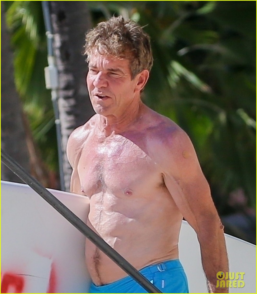 Dennis Quaid, 65, & New Fiancee Laura Savoie, 26, Show Off Ripped ...