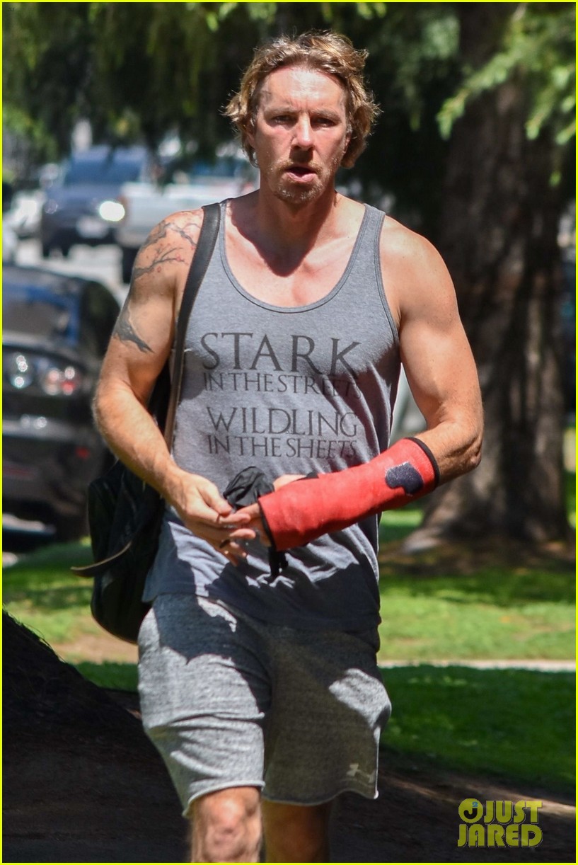 Dax Shepard Steps Out in a Cast After Performing Surgery on Himself ...