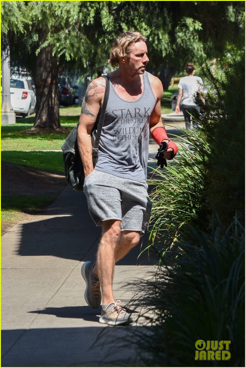 Dax Shepard Steps Out in a Cast After Performing Surgery on Himself ...