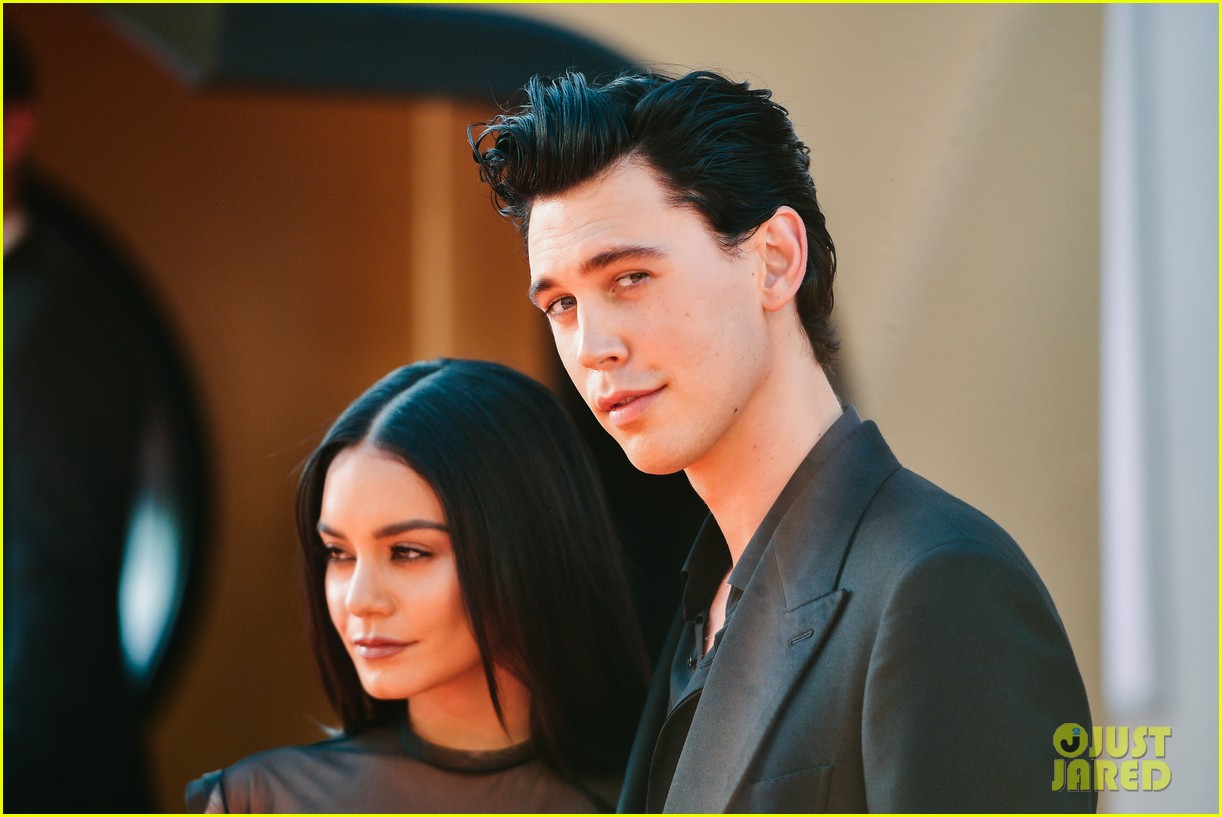 Austin Butler Says He Was 'Rushed to the Hospital' After Wrapping ...