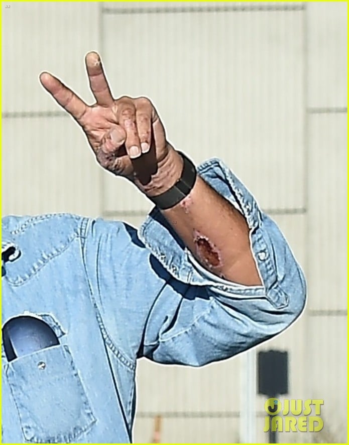 Jay Leno Appears in Good Spirits After Being Released from Burn Center (New Photos): Photo ...