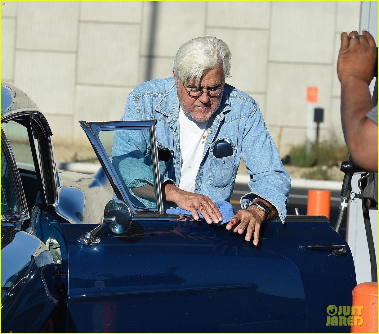 Jay Leno Appears in Good Spirits After Being Released from Burn Center (New Photos): Photo ...