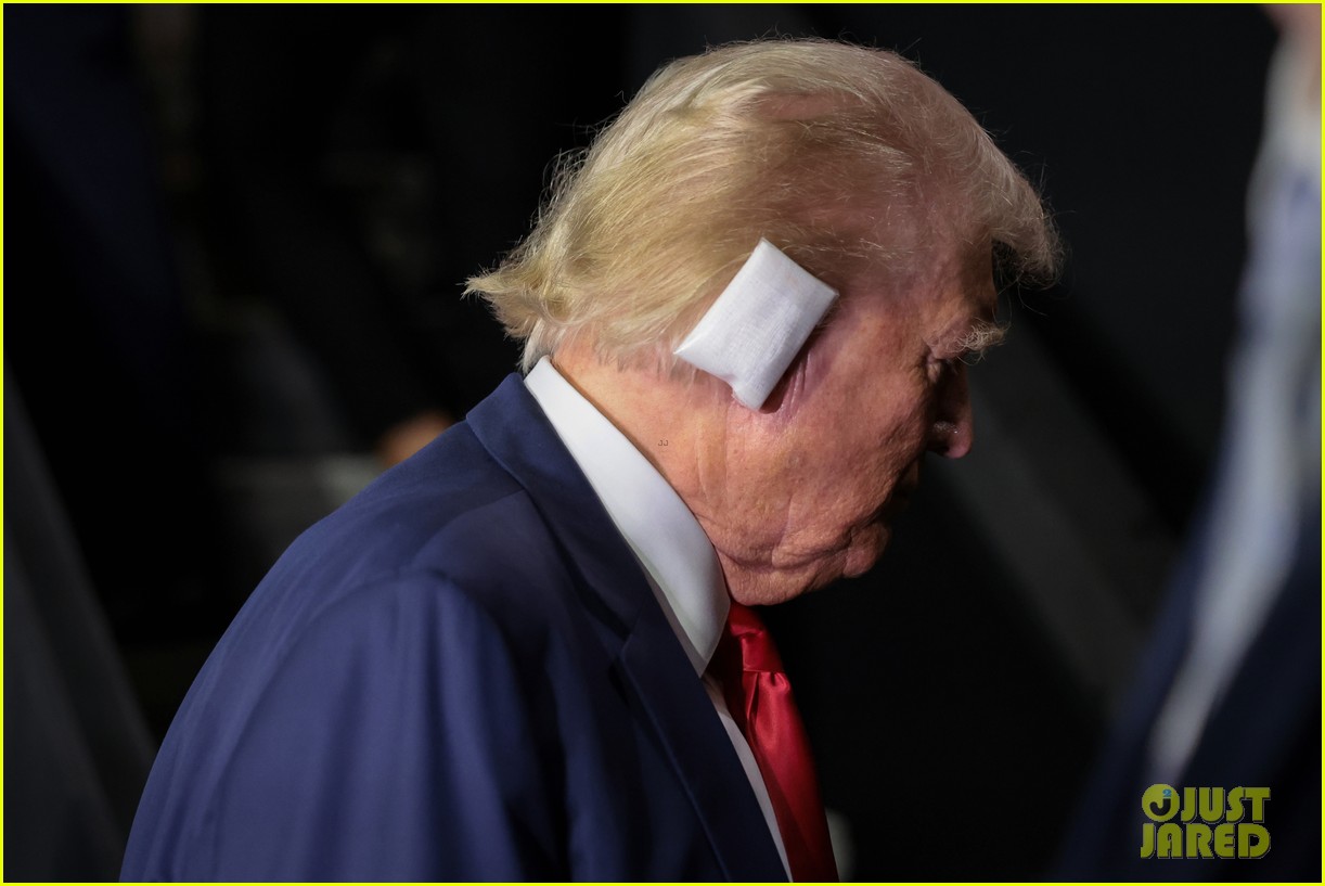 Donald Trump Wears Bandage Over Ear for First Appearance Since ...