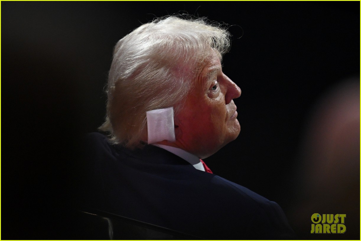 Donald Trump Wears Bandage Over Ear for First Appearance Since ...
