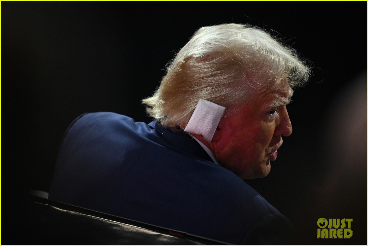 Donald Trump Wears Bandage Over Ear for First Appearance Since ...