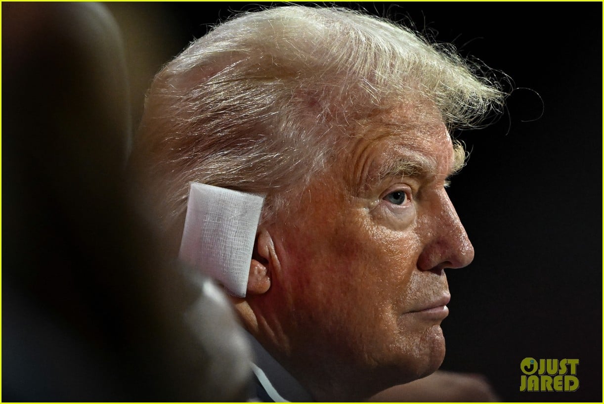 Donald Trump Wears Bandage Over Ear for First Appearance Since ...