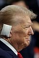 Donald Trump Wears Bandage Over Ear for First Appearance Since ...