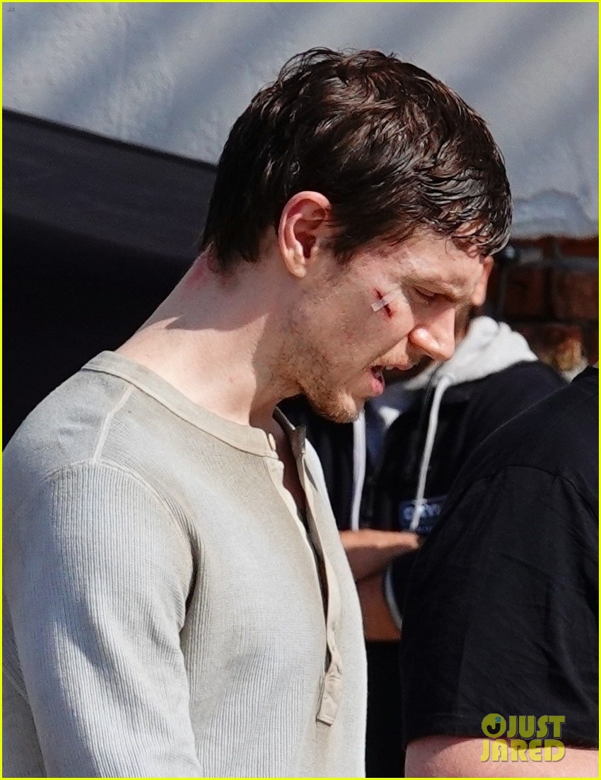 Evan Peters Is Bloody & Bruised in New 'The Beauty' Set Photos for Ryan ...