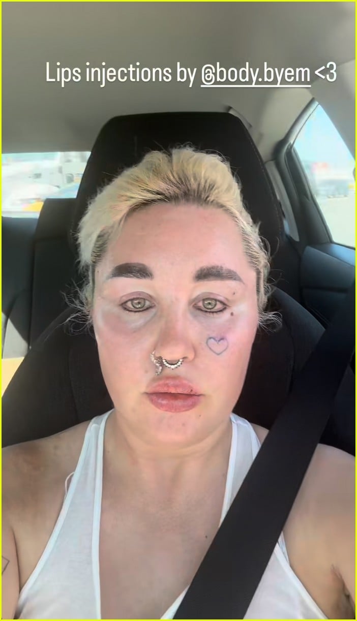 Amanda Bynes Shows Off Lip Injections In New Video: Photo 5192730 ...