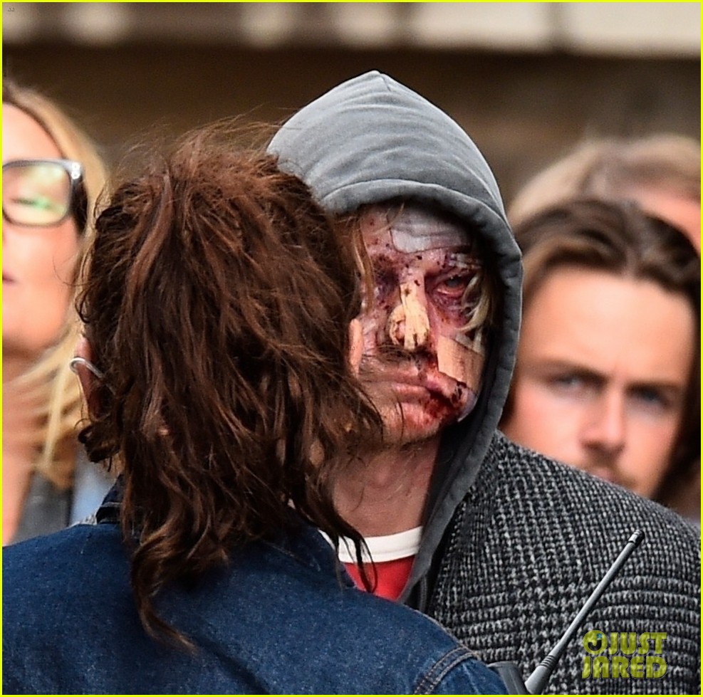 'Clayface' Set Photos: Tom Rhys Harries Seen With Bloodied & Bandaged ...