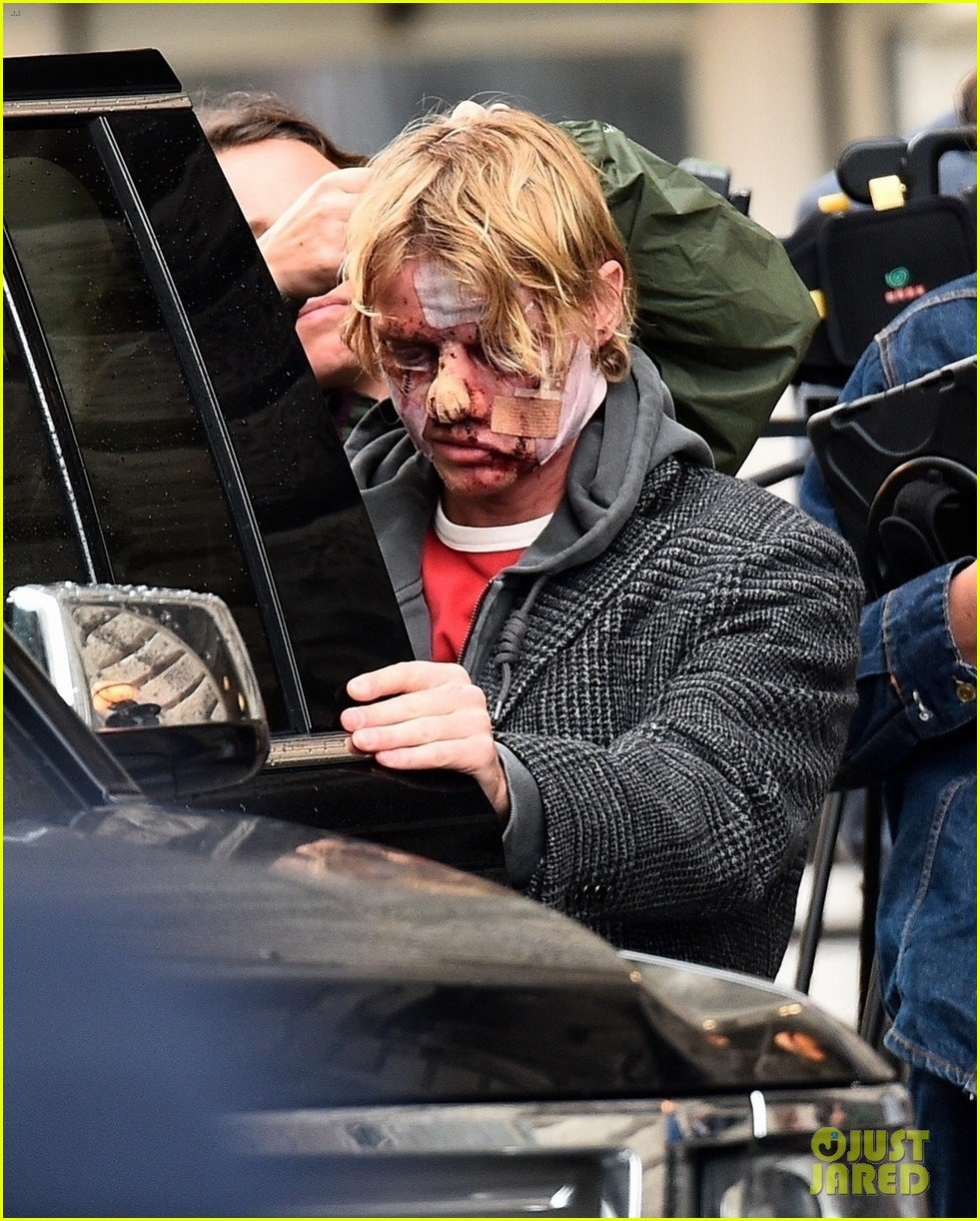 'Clayface' Set Photos: Tom Rhys Harries Seen With Bloodied & Bandaged ...