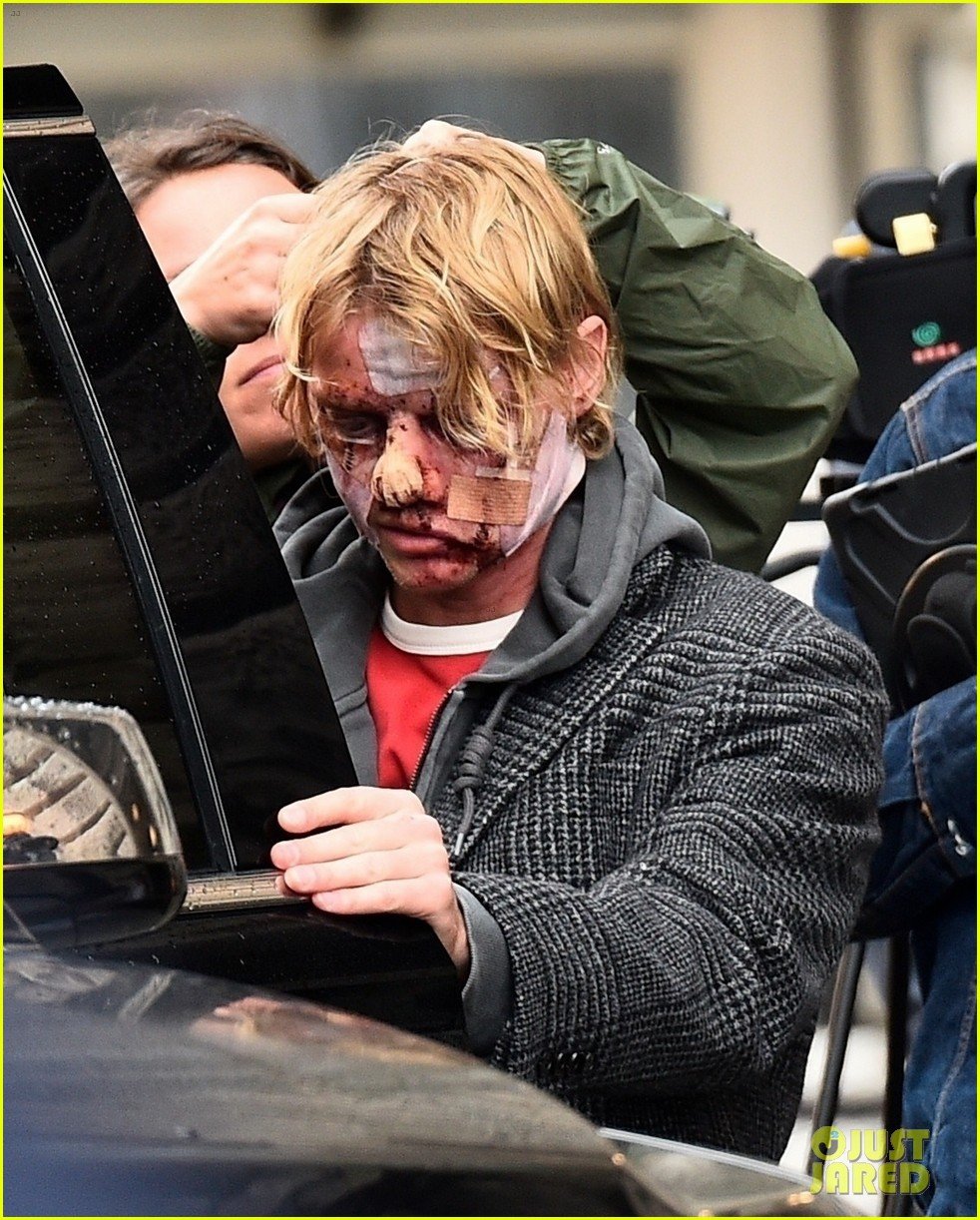 'Clayface' Set Photos: Tom Rhys Harries Seen With Bloodied & Bandaged ...