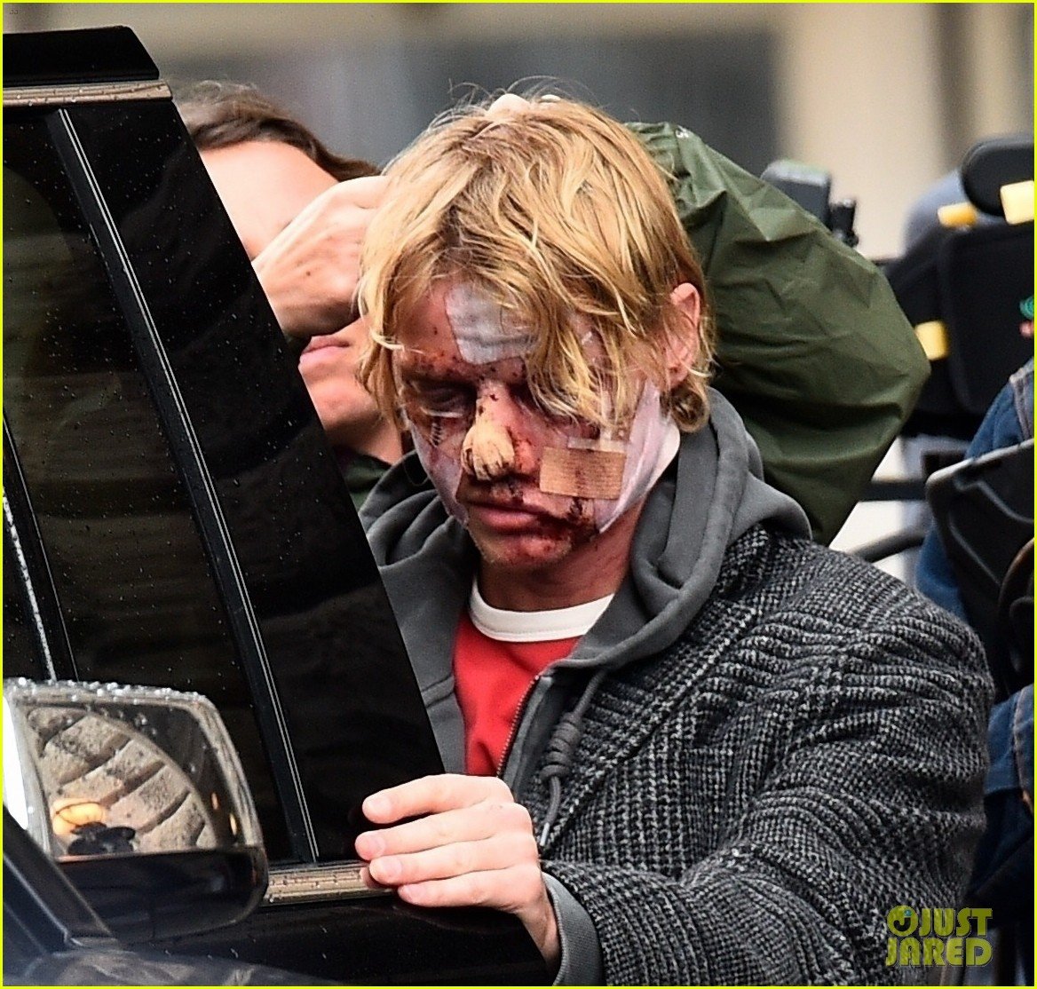 'Clayface' Set Photos: Tom Rhys Harries Seen With Bloodied & Bandaged ...