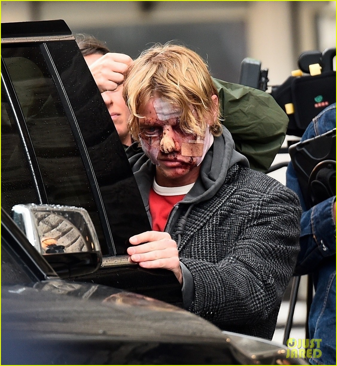 'Clayface' Set Photos: Tom Rhys Harries Seen With Bloodied & Bandaged ...