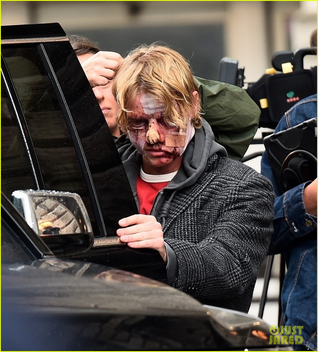 'Clayface' Set Photos: Tom Rhys Harries Seen With Bloodied & Bandaged ...
