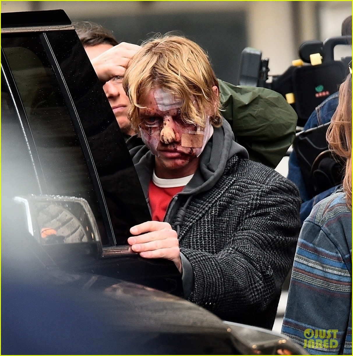 'Clayface' Set Photos: Tom Rhys Harries Seen With Bloodied & Bandaged ...