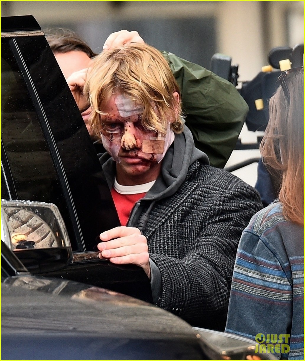 'Clayface' Set Photos: Tom Rhys Harries Seen With Bloodied & Bandaged Face: Photo 5196497 ...