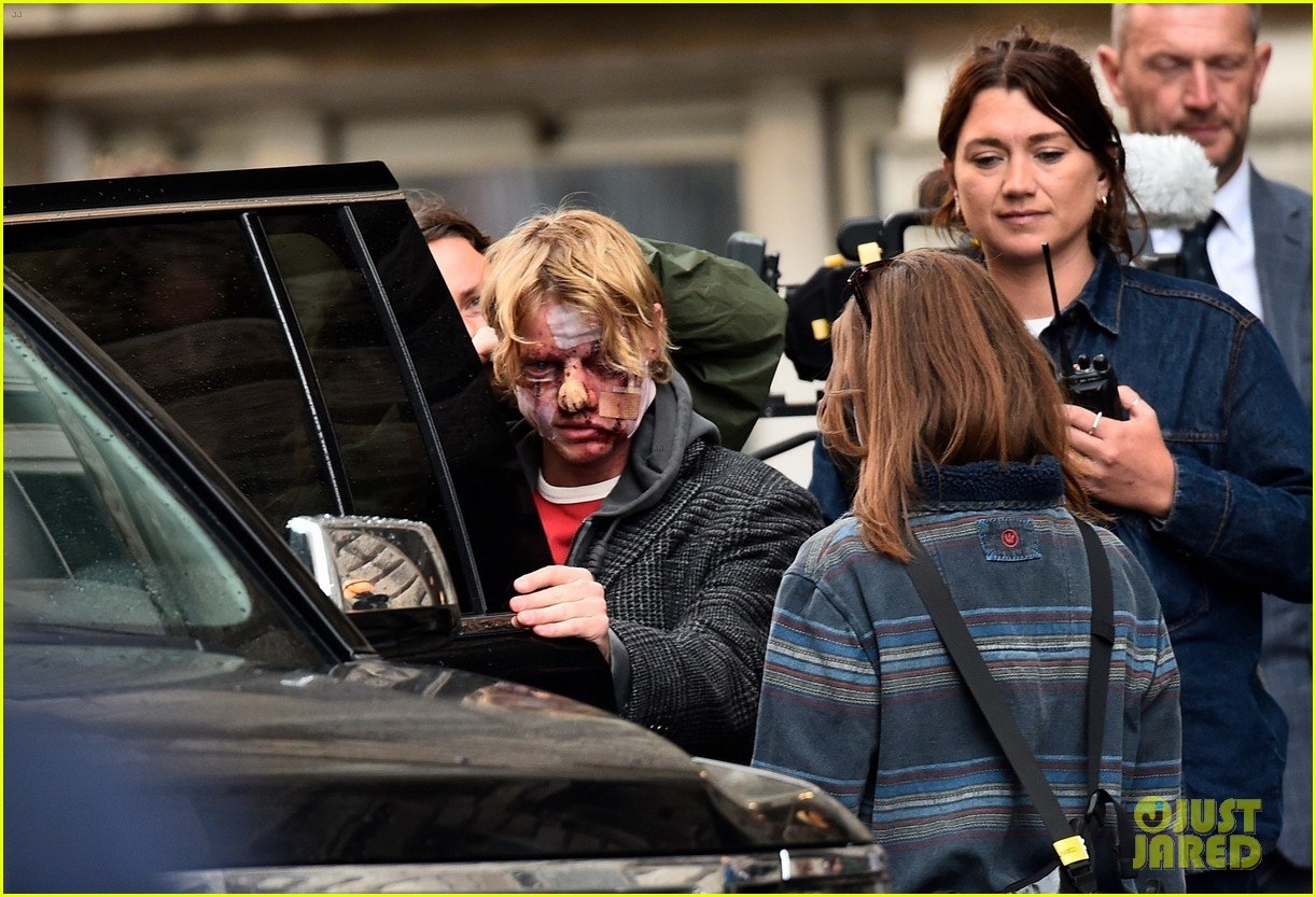 'Clayface' Set Photos: Tom Rhys Harries Seen With Bloodied & Bandaged Face: Photo 5196499 ...