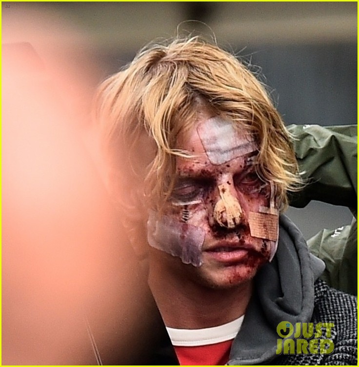 'Clayface' Set Photos: Tom Rhys Harries Seen With Bloodied & Bandaged ...