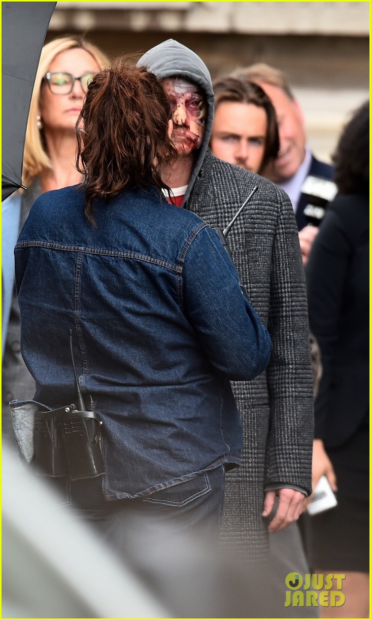 'Clayface' Set Photos: Tom Rhys Harries Seen With Bloodied & Bandaged ...