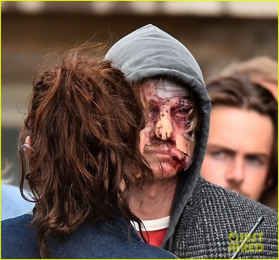 'Clayface' Set Photos: Tom Rhys Harries Seen With Bloodied & Bandaged ...