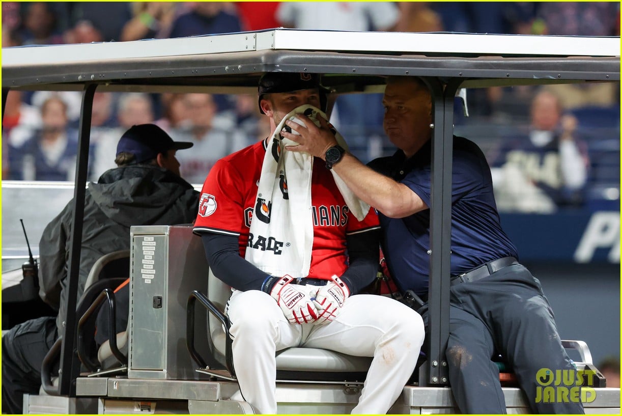 MLB's David Fry Hit in Face with 99 MPH Fastball, Rushed to Hospital (Graphic Photos & Video ...