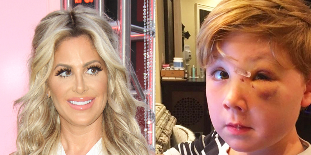Kim Zolciak Shares Photo of Son Kash’s Dog Bite Aftermath | Celebrity Babies, Kash Biermann, Kim ...