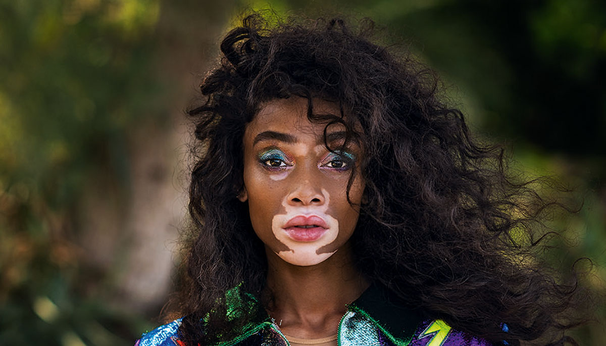 Winnie Harlow Dishes on Her Friendships with Bella Hadid & Nicki Minaj ...