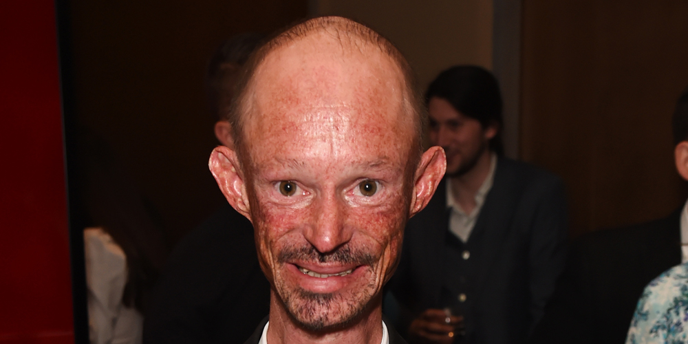 Game of Thrones’ Darren Kent Passes Away at 36 | Darren Kent, RIP ...