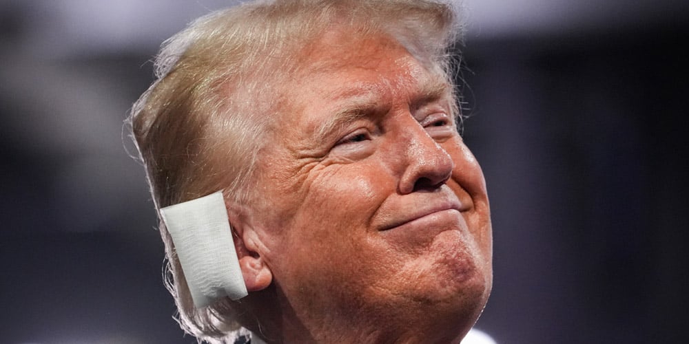 Donald Trump’s Doctor Explains Full Extent of Ear Injury, If He Lost ...