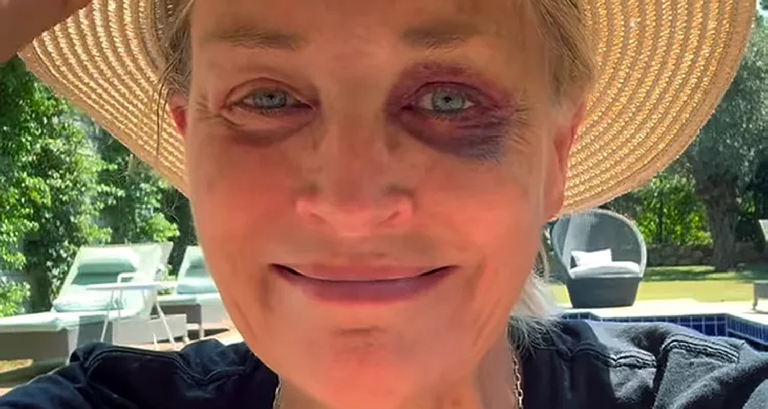 Sharon Stone Explains How She Got Her Black Eye | Sharon Stone | Just ...