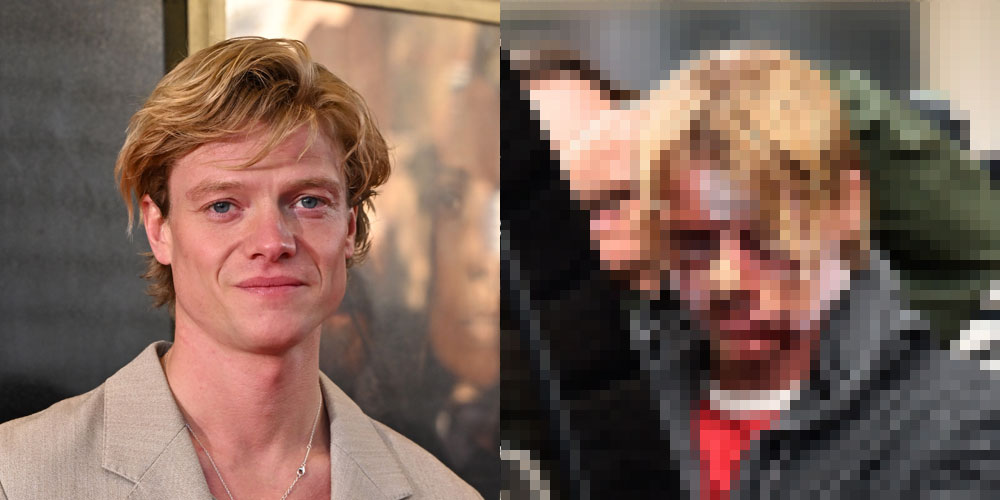 ‘Clayface’ Set Photos: Tom Rhys Harries Seen With Bloodied & Bandaged ...