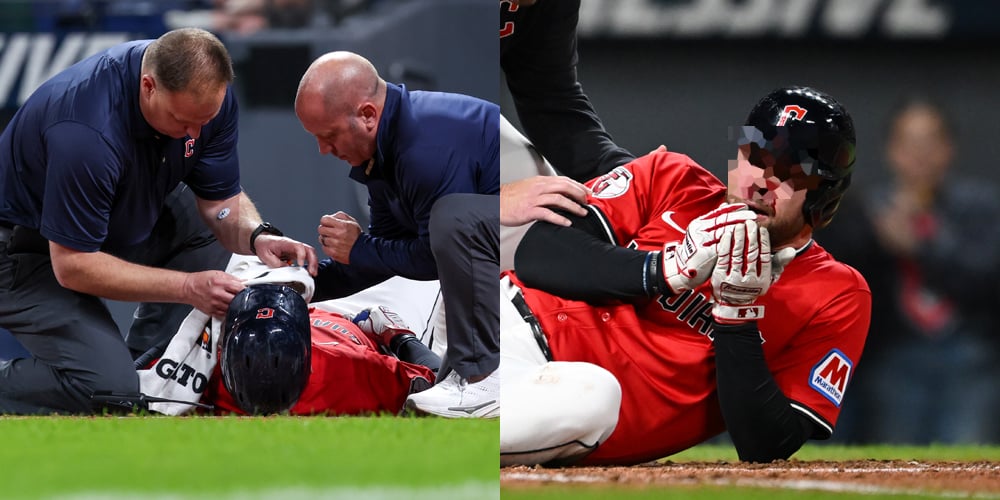 MLB’s David Fry Hit in Face with 99 MPH Fastball, Rushed to Hospital ...