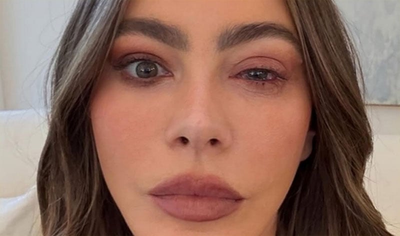 Sofia Vergara Reveals the Medical Emergency That Caused Her to Miss Emmy Awards 2025 | 2025 Emmy ...